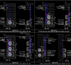 Installation single power socket outlet waterproof Electrical